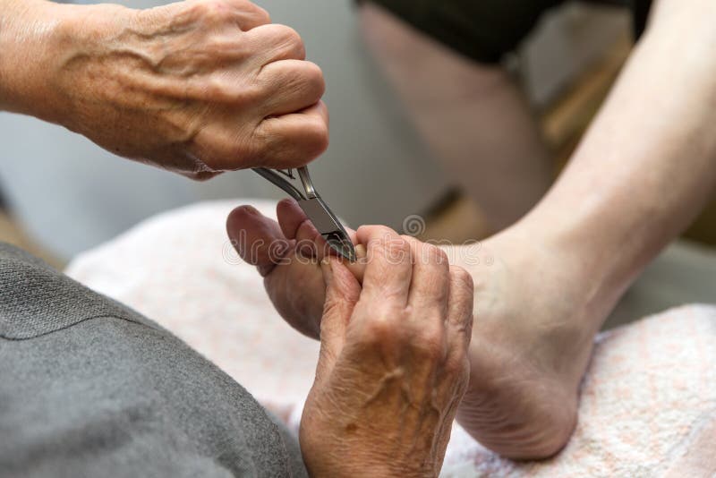 Podologist Gives a Medical Treatment Stock Image - Image of hands ...