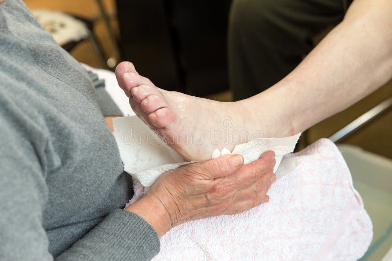 Podologist in Preparation of a Treatment of the Feet Stock Image ...