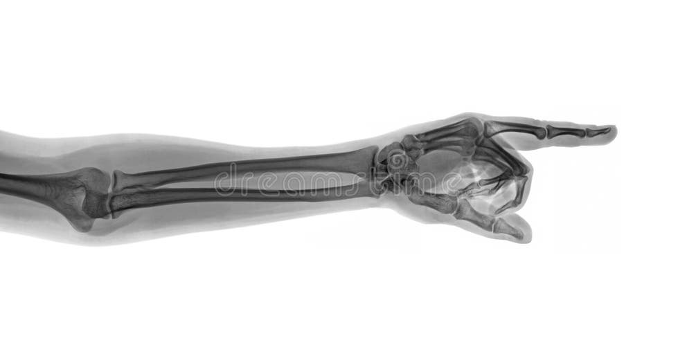 334 Skeleton Hand Pointing Stock Photos - Free & Royalty-Free Stock ...