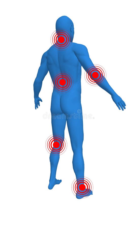 Points of pain stock illustration. Illustration of adjustment - 13071829