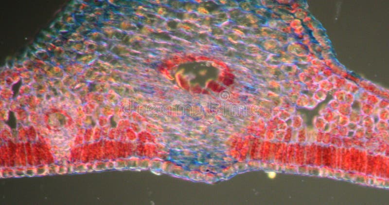 Poisson evy leave stock footage. Video of science, tissue - 206761340