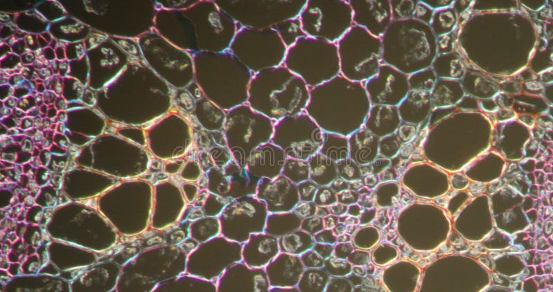 Poisson Ivy Stem in Darkfield Stock Video - Video of cells, research ...