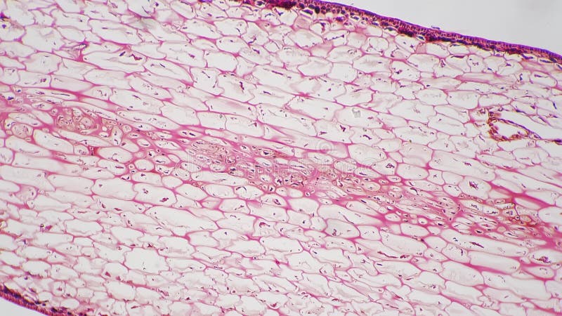 Polliondium of Funaria in Longitudinal Section Under Microscope 40x ...