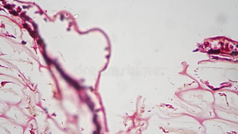 Polliondium of Funaria in Longitudinal Section Under Microscope 40x ...