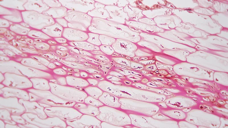 Polliondium of Funaria in Longitudinal Section Under Microscope 200x ...