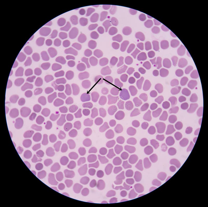 Polychromasia imagen de archivo. Imagen de microscopio - 63194275