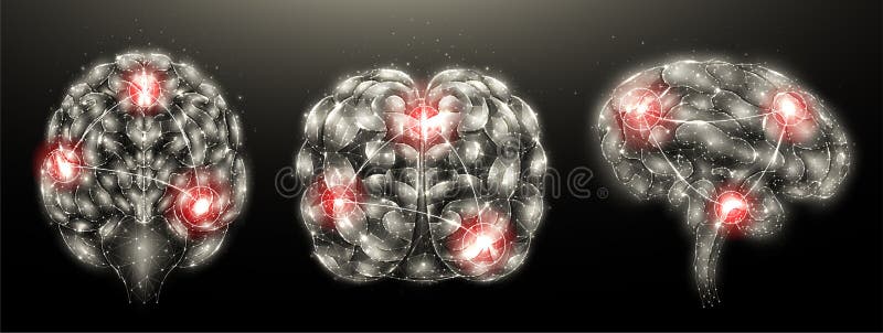 Polygonal Illustration of Human Brain Inflammatory Disease on a Dark ...