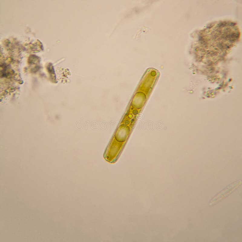 Pond Water Plankton and Algae at the Microscope. Diatoms Stock Photo ...