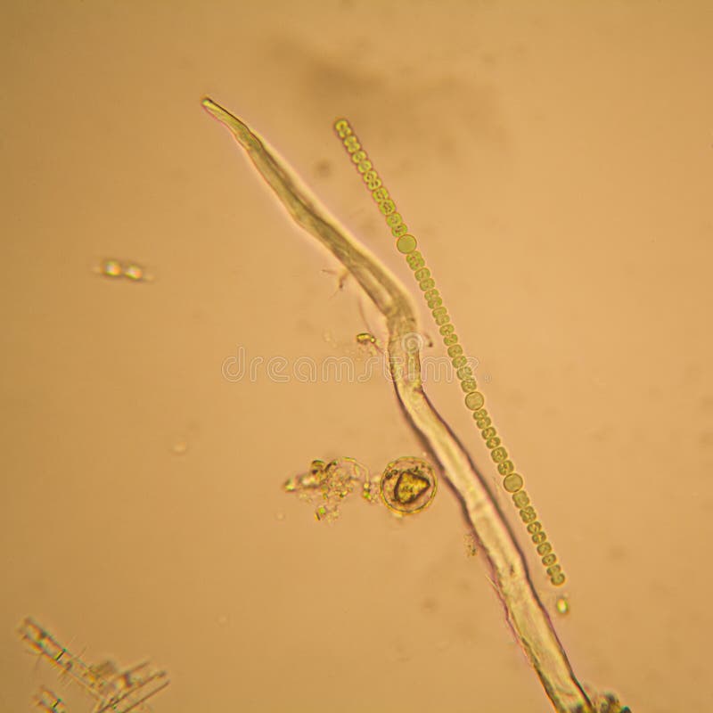Pond Water Plankton and Algae at the Microscope. Nostoc Commune Stock ...