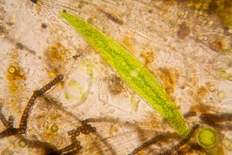 Nostoc Sp. Algae Under Microscopic View, Cyanobacteria, Providing ...