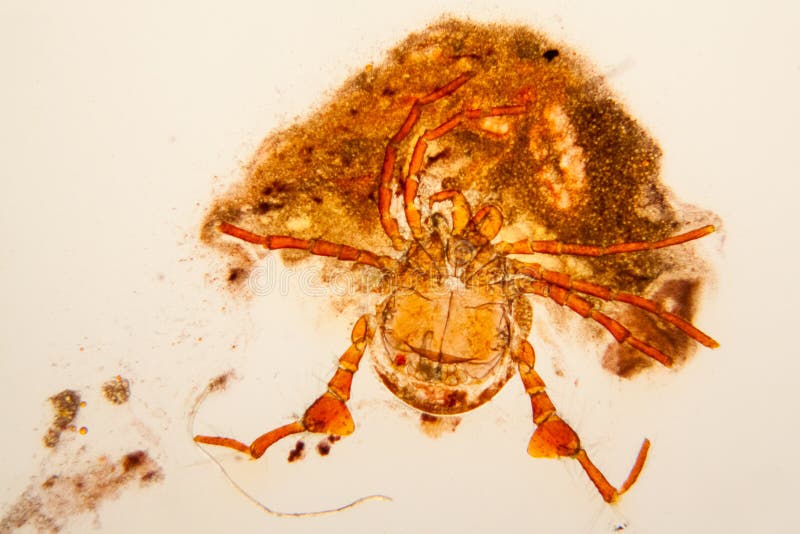 Pond Water Plankton and Algae at the Microscope. Pond Mite Stock Photo ...