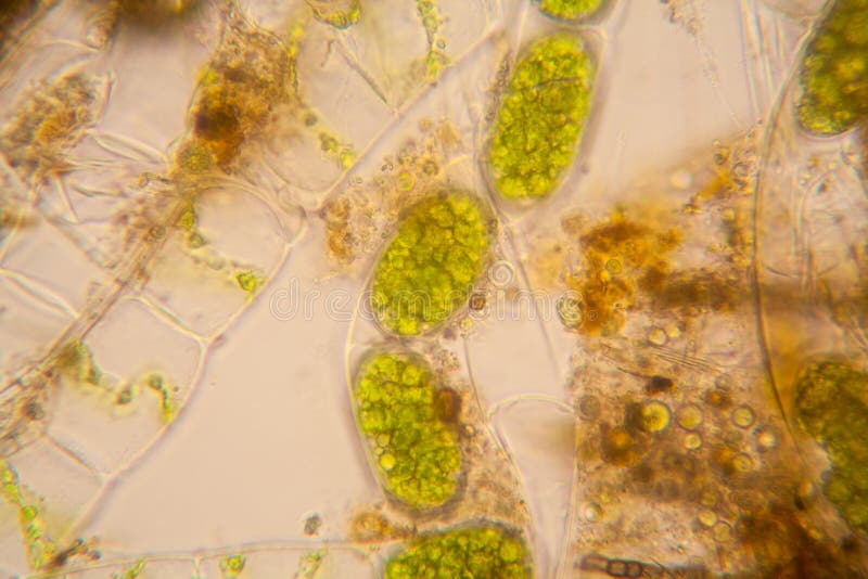 Pond Water Plankton and Algae at the Microscope.Volvox Aureus Stock ...