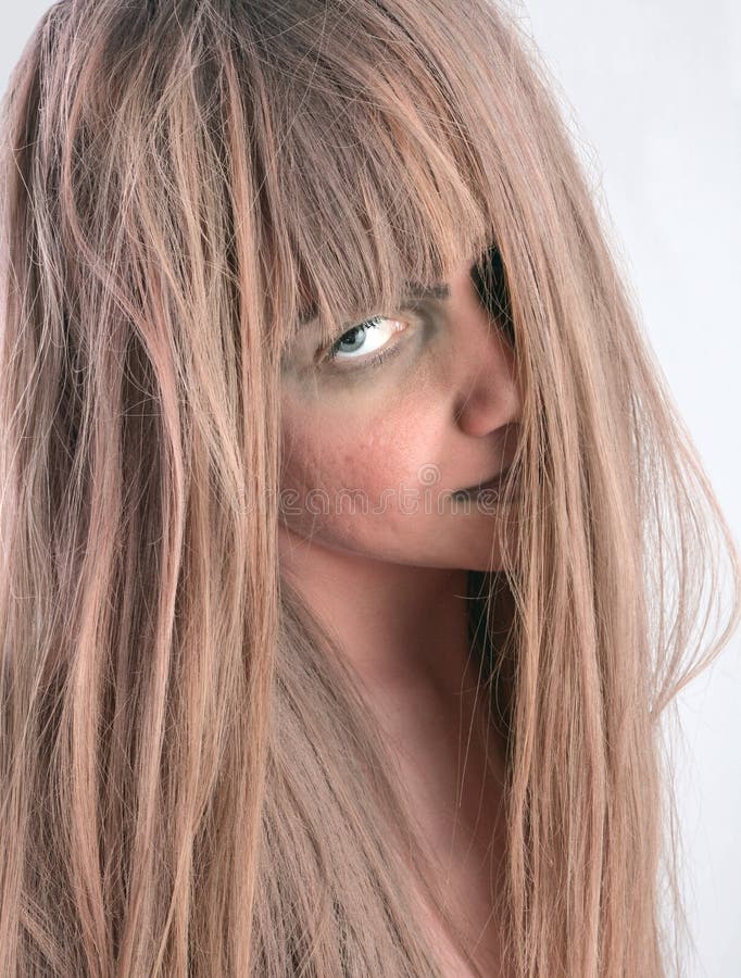 Poor Condition of the Girl`s Hair Stock Photo - Image of health, face ...