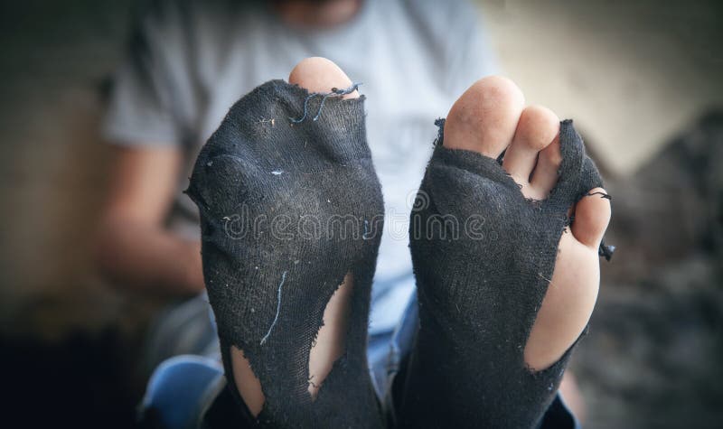 Poor Feets of a Caucasian Homeless Man Stock Image - Image of adult ...