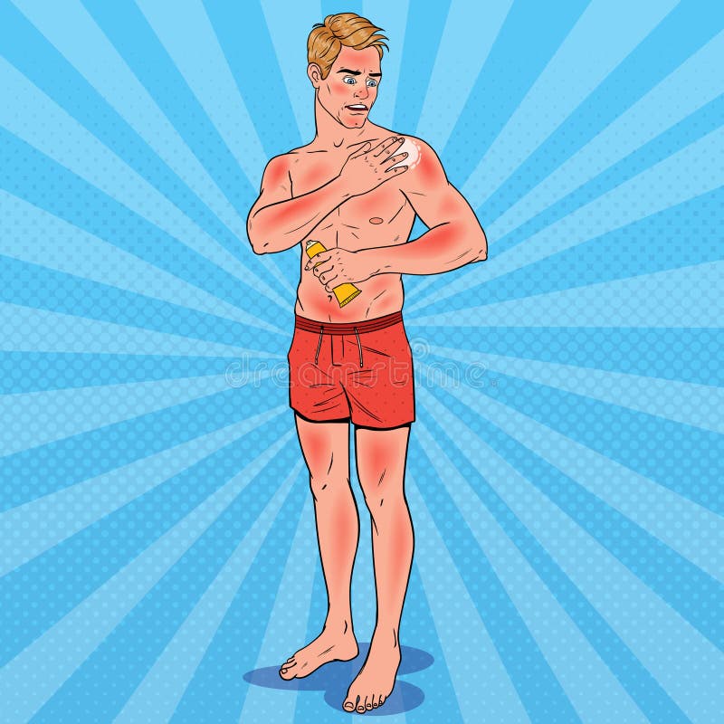 Pop Art Man With Sunburn Tourist Applying Suncream On Sunburned Skin
