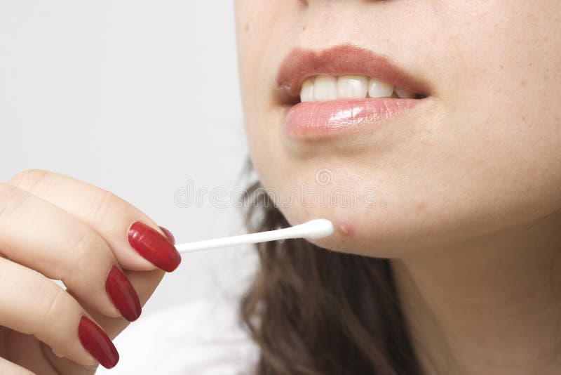 Popping a zit stock image. Image of female, caucasian - 8128917