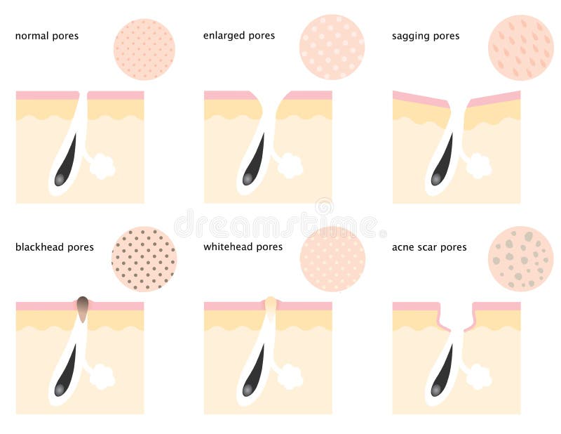Pores Stock Illustrations, Vecteurs, & Clipart – (847 Stock Illustrations) Pores Stock Illustrations, Vecteurs, & Clipart – (847 Stock Illustrations)