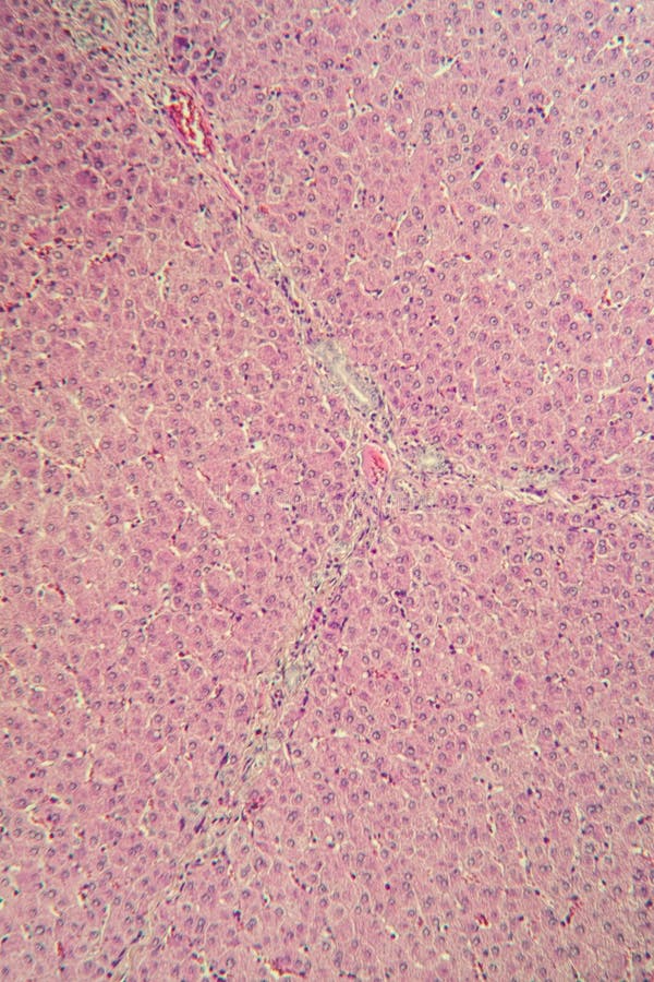 Pork liver tissue cut stock image. Image of doctor, liver - 195441781