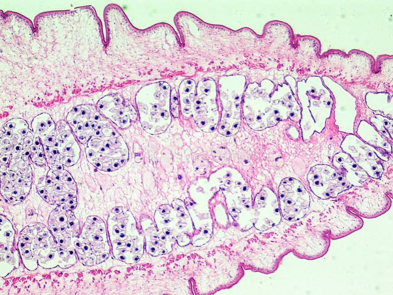 Pork Tapeworm Taenia Solium Stock Photo - Image of taenia ...