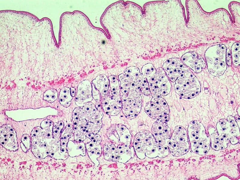 Pork Tapeworm Taenia Solium Stock Image - Image of taenia, parasites ...