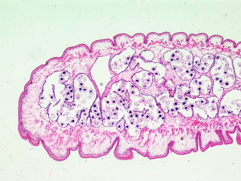 Pork Tapeworm Taenia Solium Stock Photo - Image of taenia ...