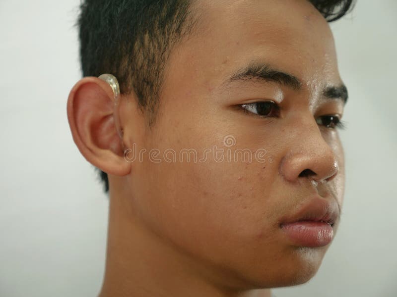 Portrait of Asian Boy Wearing Hearing Aid Device Stock Image - Image of ...