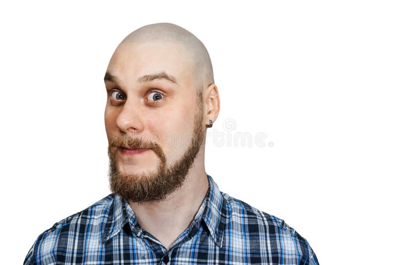 Bald Man Looking at His Balding Head. Hair Transplant Concept Stock ...