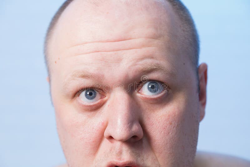 Portrait of a Bald Man Who Bulged His Eyes. Stock Image - Image of ...