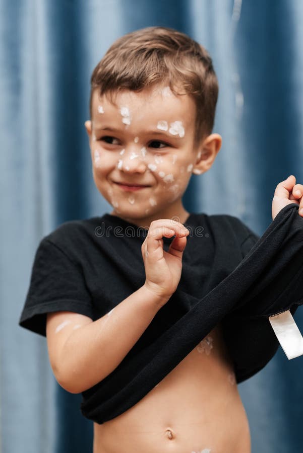 Portrait of a Boy with Chickenpox. Stock Image - Image of caucasian ...