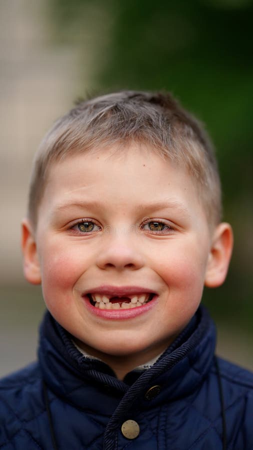 Portrait of a Boy with Fallen Front Teeth. Baby Smiling Stock Photo ...