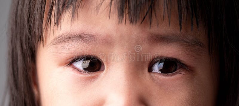 Portrait of Child Half Face with Sad and Cry Expression Stock Photo ...