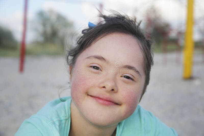 Portrait of Down Syndrome Girl Smiling Stock Image - Image of latin ... Portrait of Down Syndrome Girl Smiling Stock Image - Image of latin ...