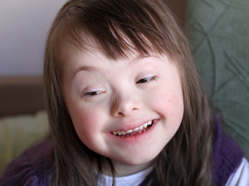 Cute Little Girl With Down Syndrome Stock Photo - Image of cheerful ...