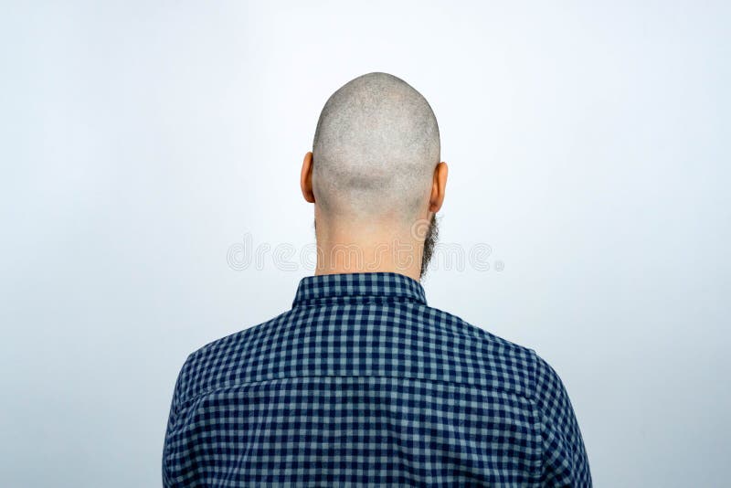 Portrait of Head Bald Man with Alopecia, Back View Stock Photo - Image ...
