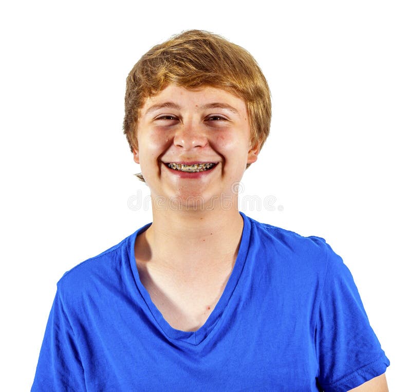 114 Teen Boy Retainer Stock Photos - Free & Royalty-Free Stock Photos ...