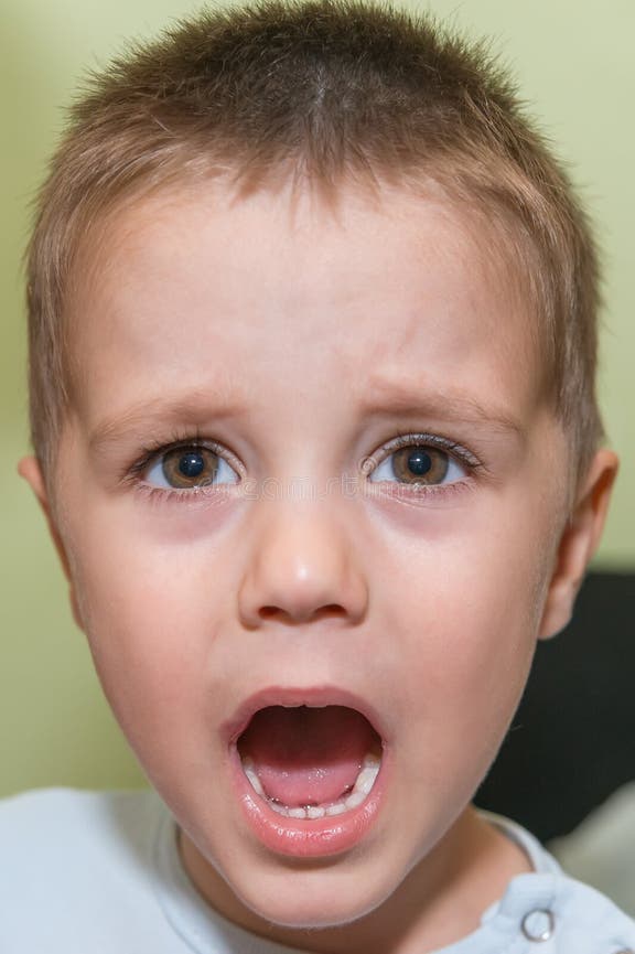 Portrait of Upset and Angry Boy Stock Photo - Image of cast, gypsum ...