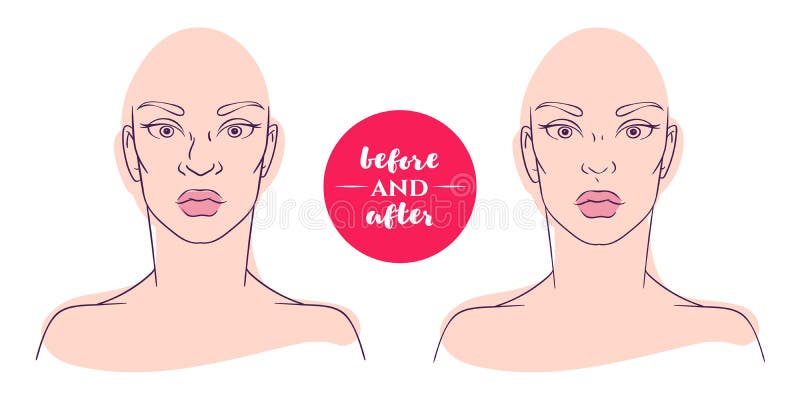 Portrait of a Woman before and after with Cosmetic Defects. Stock ...