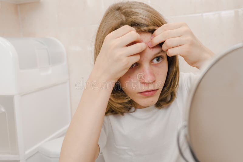 Skin defects concept stock photo. Image of cosmetic - 258023986