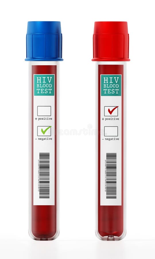 Positive and Negative Blood Samples in Vials with HIV Test Labels. 3D ...