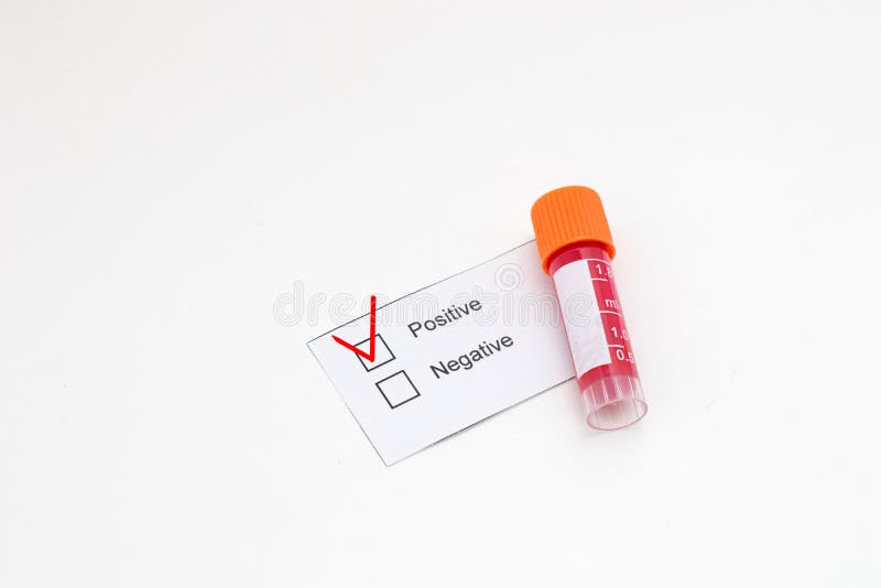 Positive Test and Laboratory Sample of Blood Testing Tube Stock Image ...