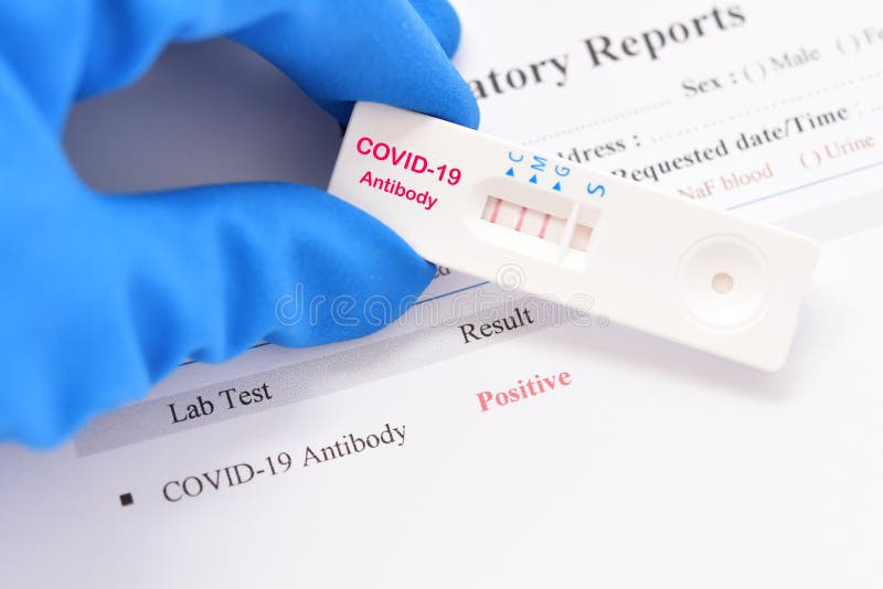 Positive Test Result of COVID-19 by Using Rapid Test Stock Image ...