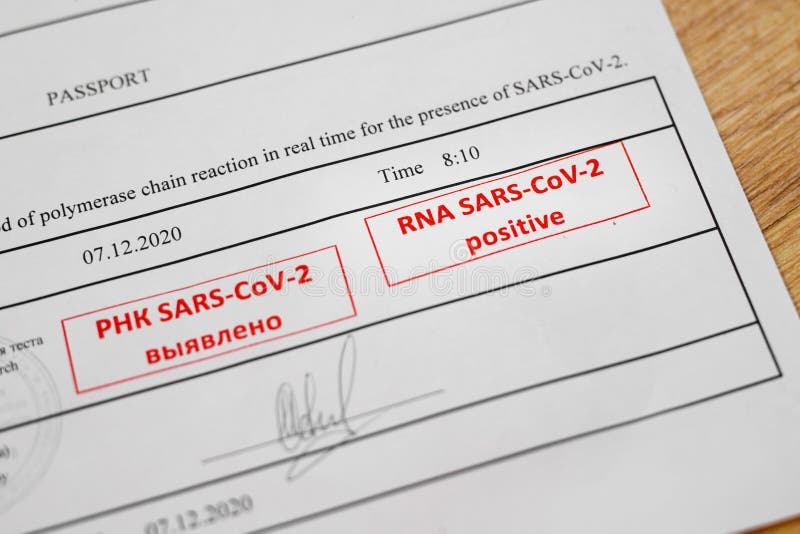 Positive Test Result for COVID-19 Virus. Editorial Photography - Image ...