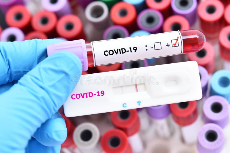 Positive Test Result by Using Rapid Test Device for COVID-19 Virus ...