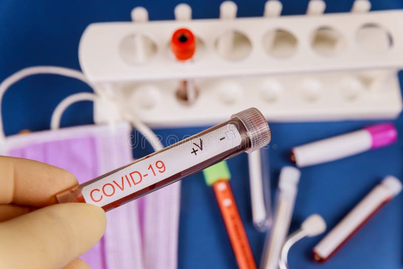 Positive Test Result by Using Rapid Test Device for Infected Blood ...