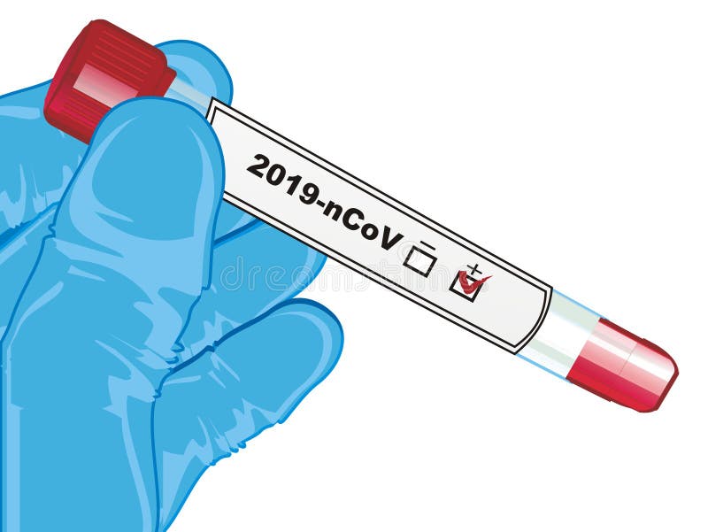 Positive test of virus stock illustration. Illustration of medic ...