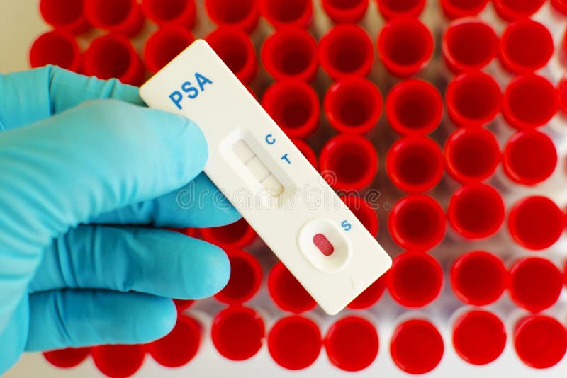 Prueba del PSA foto de archivo. Imagen de prueba - 65172838