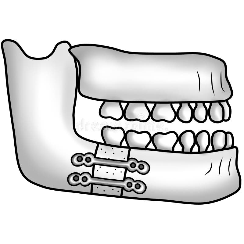 Underbite Cartoon Character Stock Photos - Free & Royalty-Free Stock ...