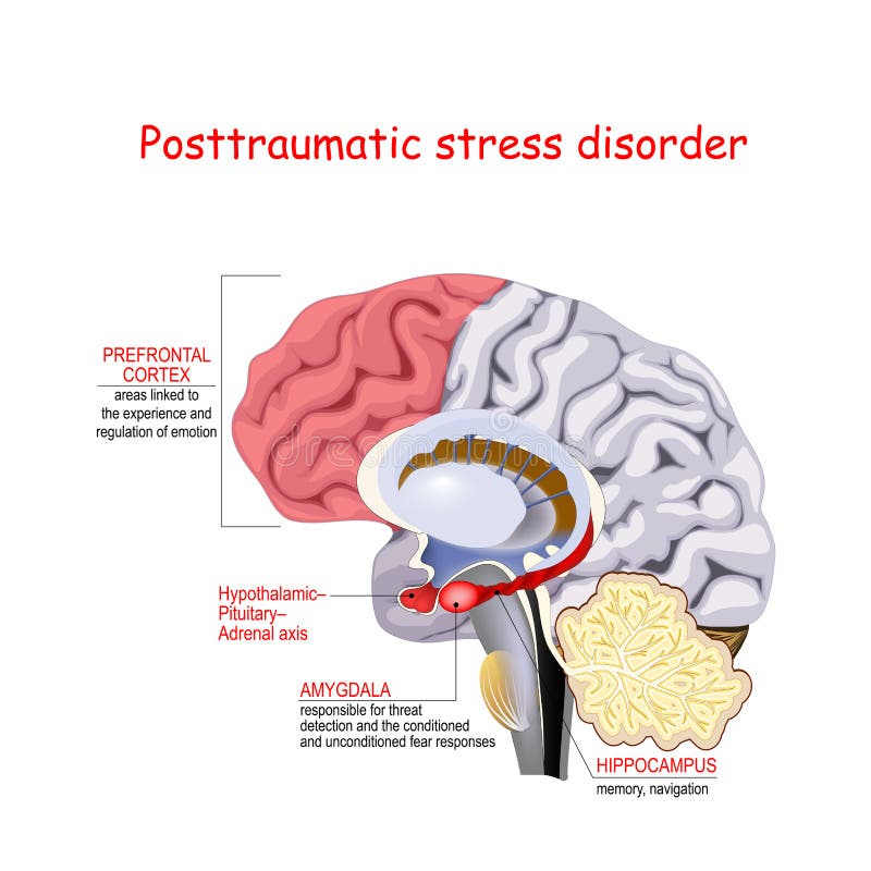 Posttraumatic Stress Disorder Stock Vector - Illustration of phobia ...