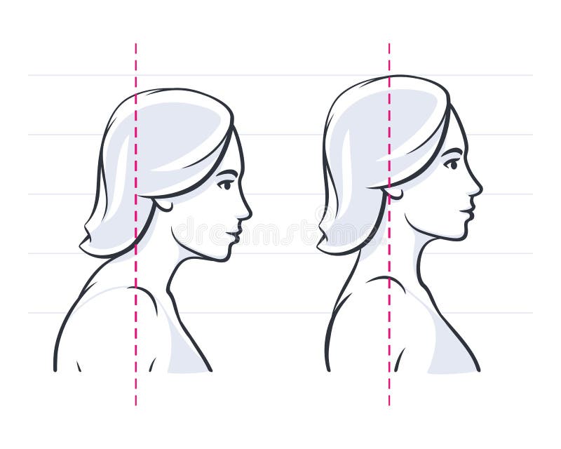 Posture Correction Neck Position Correct Posture Vector Illustration ...