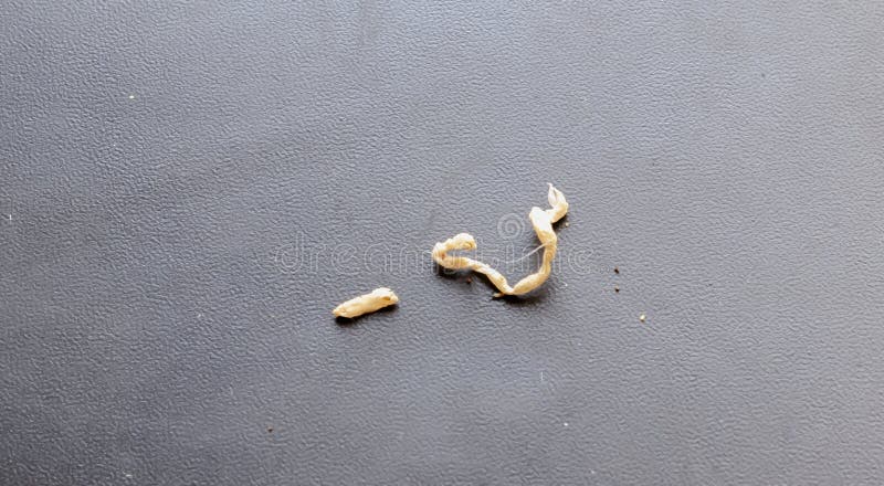 Poultry Worm on Black Surface Stock Image - Image of isolated, pathogen ...